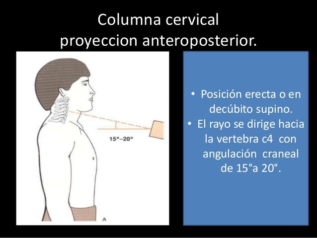 Anatomia radiografica de columna cervical