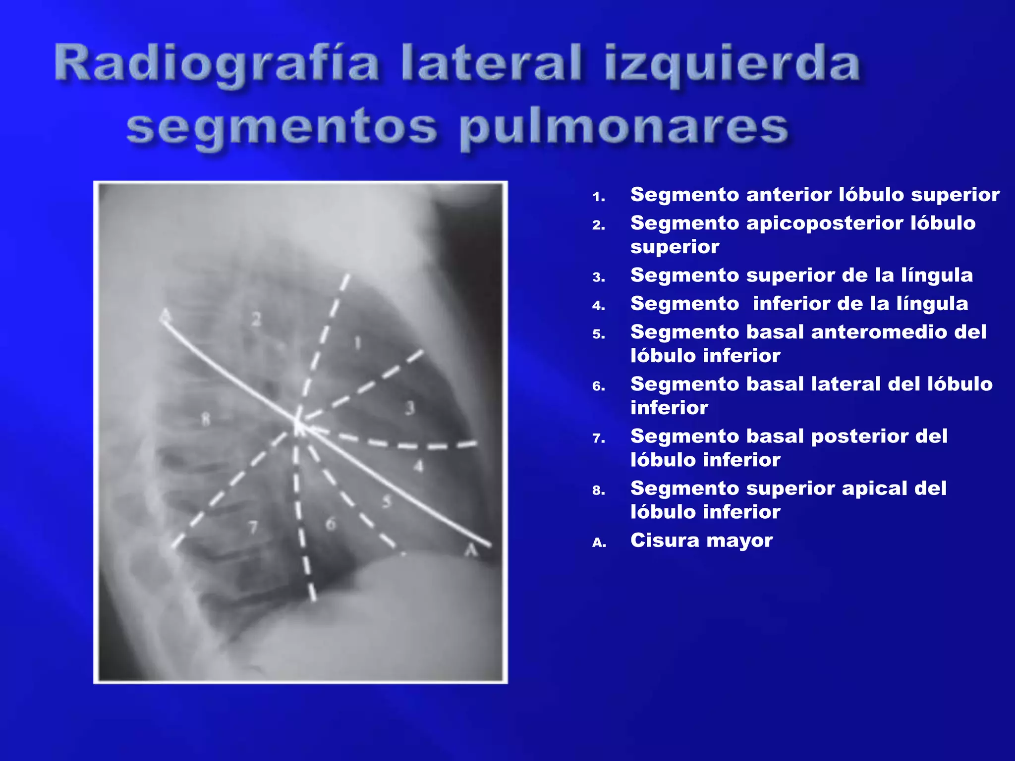 RADIOLOGIA - Anatomia radiografica del torax | PPTX