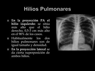 Anatomia radiografica torax | PPT