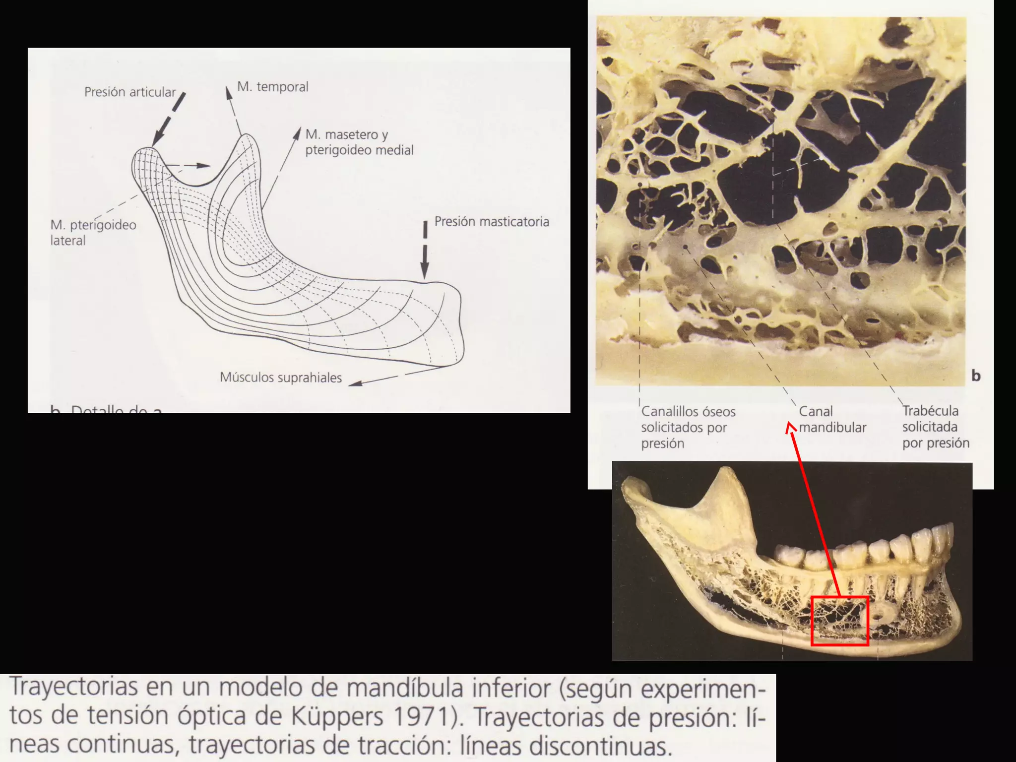 Anatomia radiográfica maxilar y mandíbula uss rx | PPT
