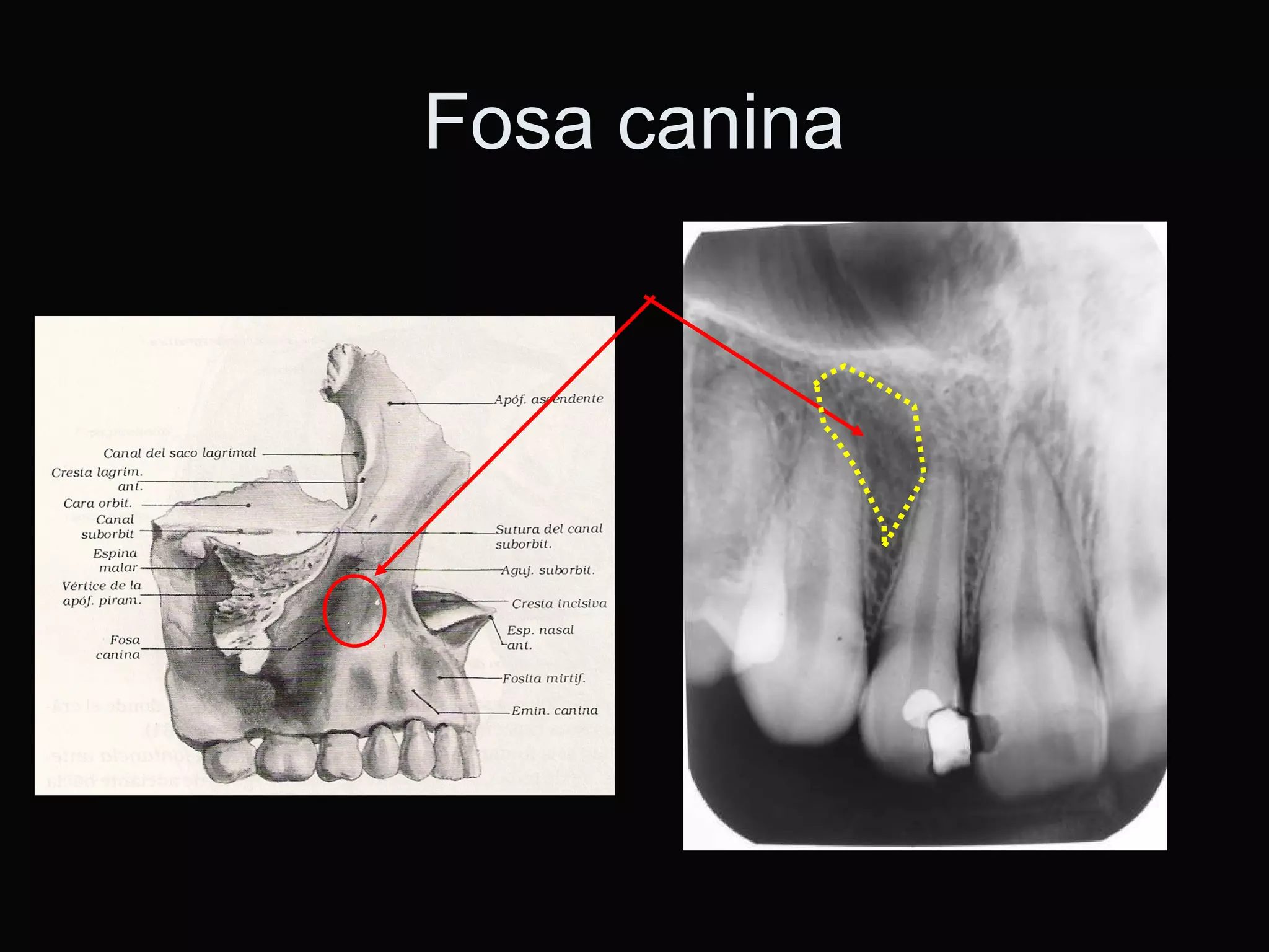 Anatomia radiográfica maxilar y mandíbula uss rx | PPT