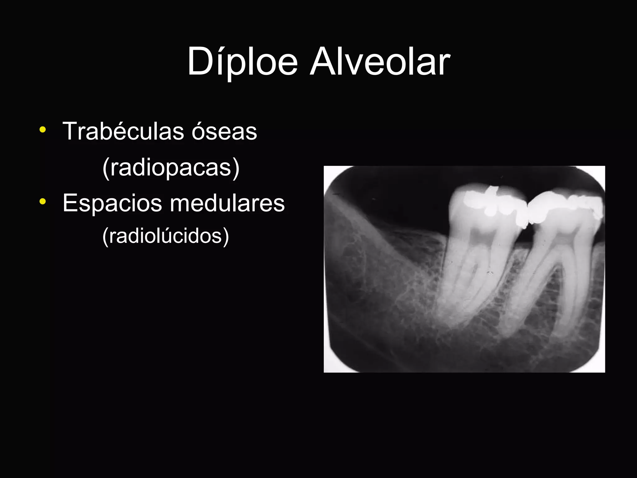 Anatomia radiográfica maxilar y mandíbula uss rx | PPT