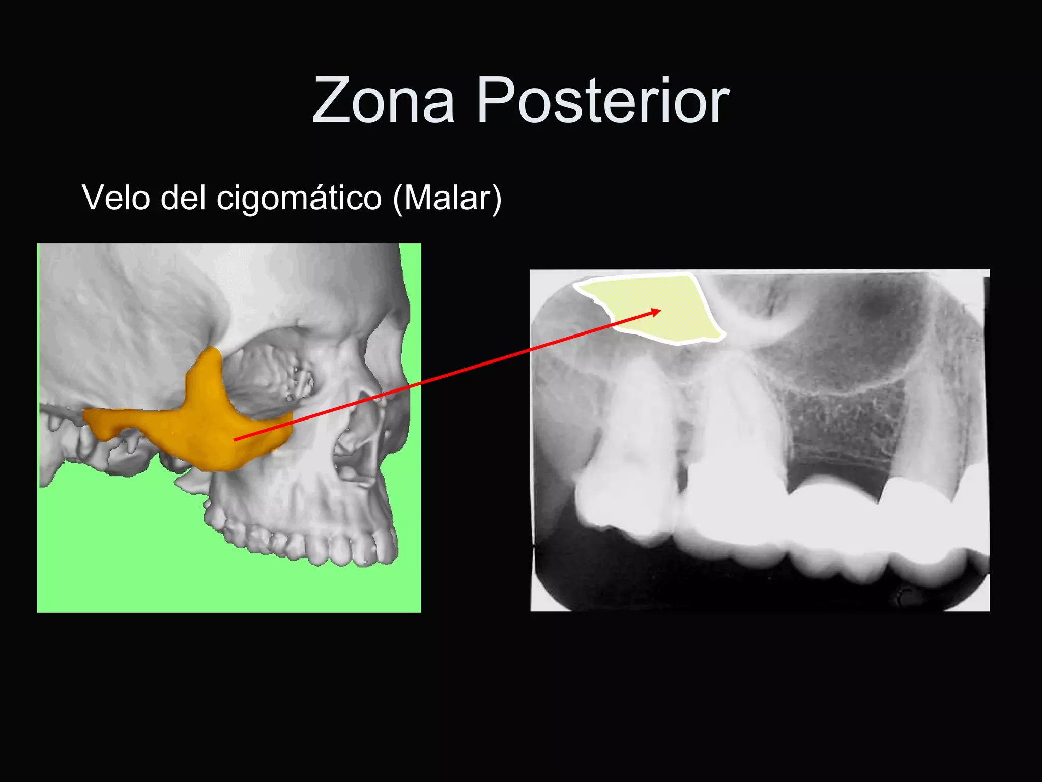 Anatomia radiográfica maxilar y mandíbula uss rx | PPT