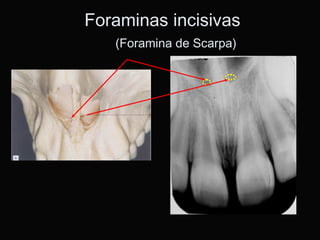 Anatomia radiográfica maxilar y mandíbula uss rx | PPT