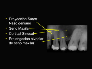 Anatomia radiográfica maxilar y mandíbula uss rx | PPT