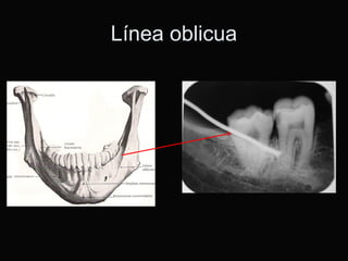 Anatomia radiográfica maxilar y mandíbula uss rx | PPT
