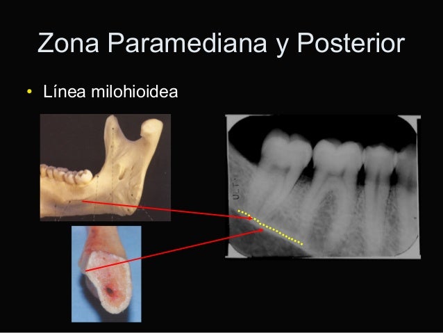 Anatomia radiográfica maxilar y mandíbula uss rx