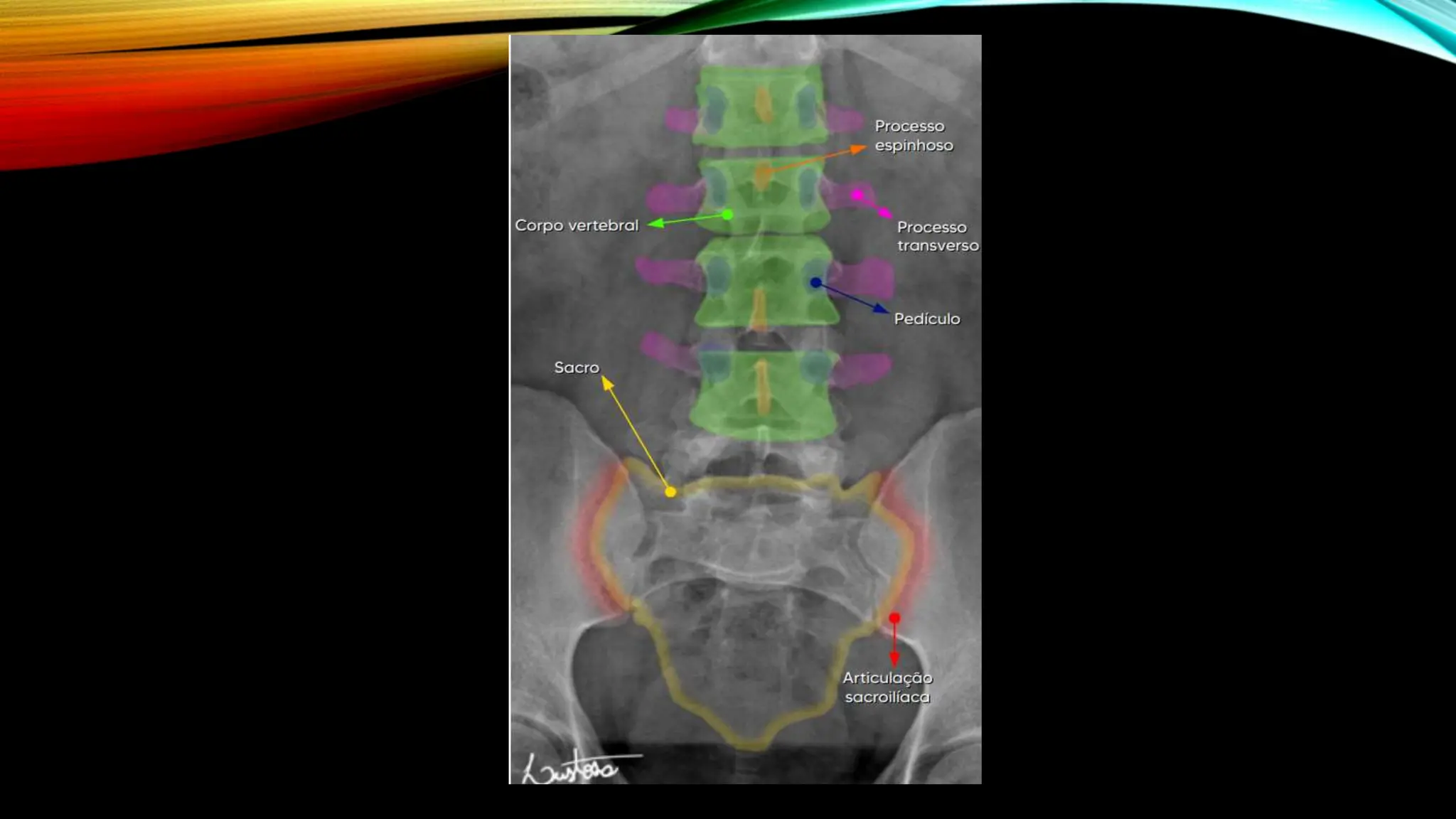 ANATOMIA RADIOLOGICA DA COLUNA CERVICAL, TORACICA E LOMBAR | PPTX
