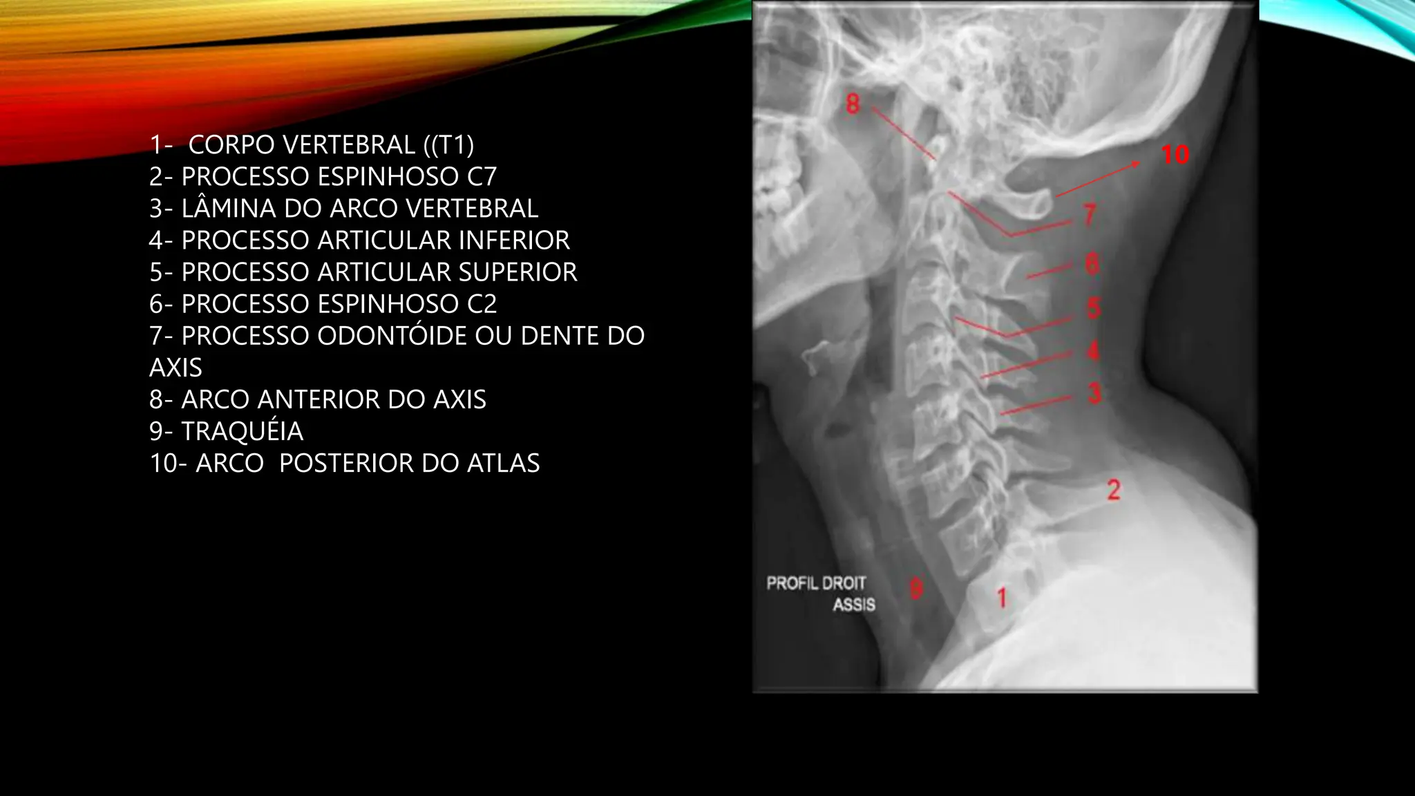 ANATOMIA RADIOLOGICA DA COLUNA CERVICAL, TORACICA E LOMBAR | PPTX