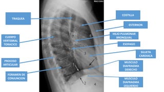 Anatomia radiologica de la columan vertebral | PPT