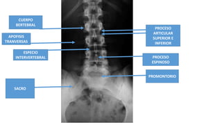 Anatomia radiologica de la columan vertebral | PPT