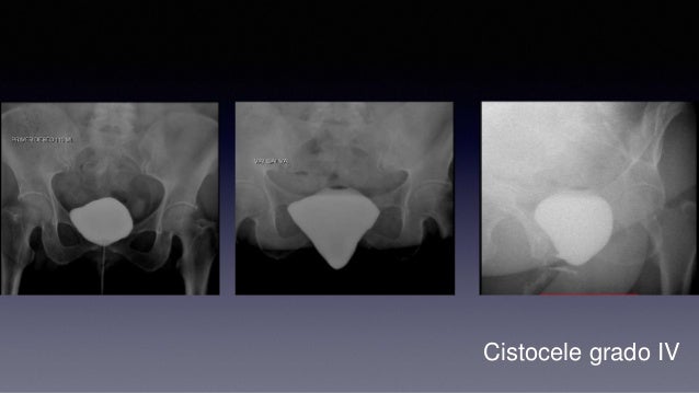 Anatomía radiológica de la pelvis