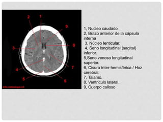 Anatomia radiologica del cerebro | PPTX