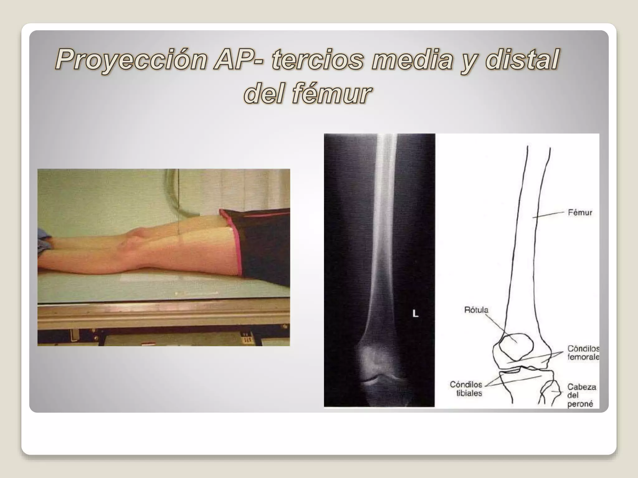 Anatomia radiologica del femur | PPTX