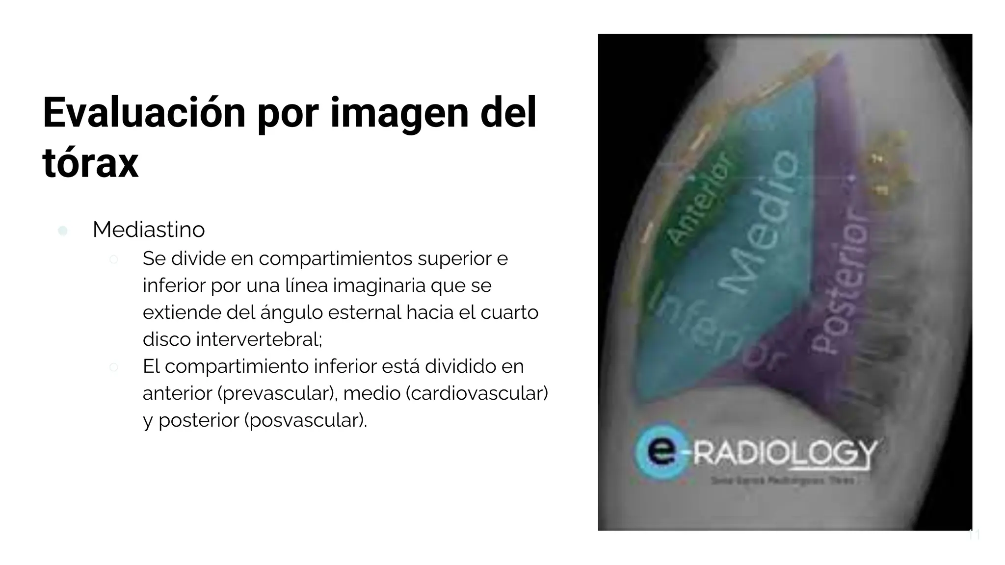 estudio de anatomia radiologica del Torax.pptx