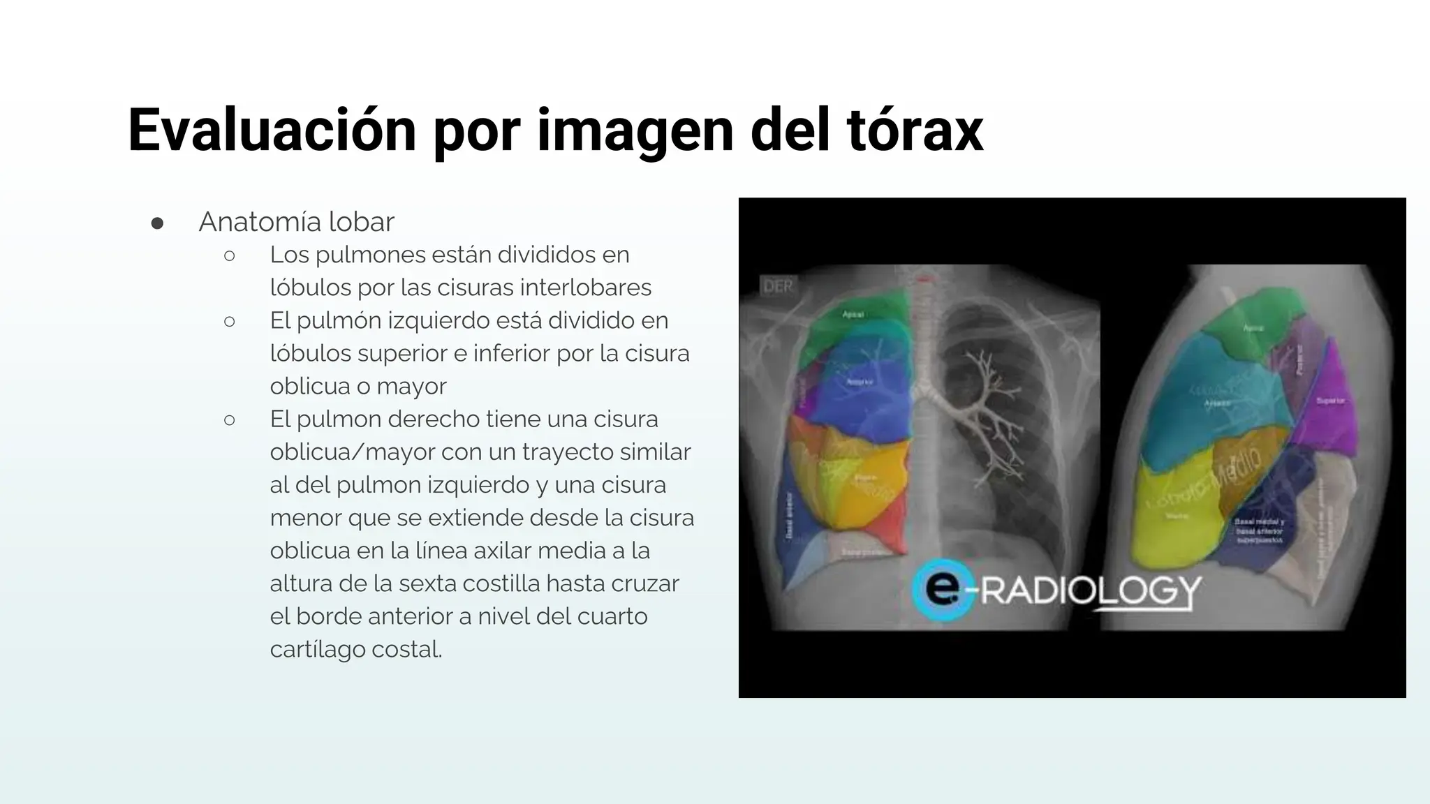 estudio de anatomia radiologica del Torax.pptx