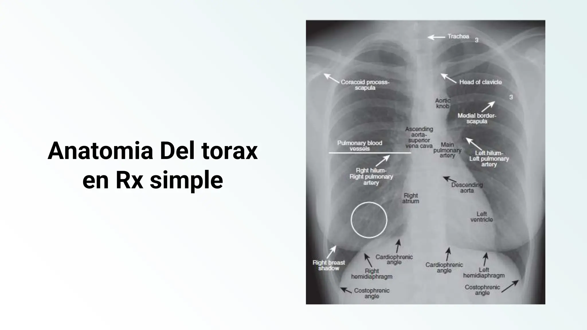 estudio de anatomia radiologica del Torax.pptx