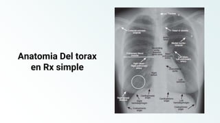 estudio de anatomia radiologica del Torax.pptx