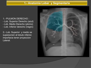 ANATOMIA RADIOLOGICA DEL TORAX 1.pptx