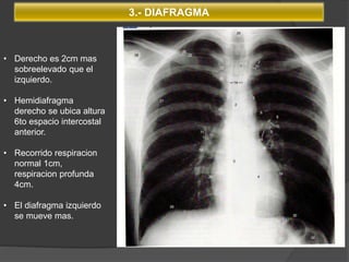 ANATOMIA RADIOLOGICA DEL TORAX 1.pptx
