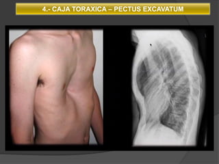 ANATOMIA RADIOLOGICA DEL TORAX 1.pptx