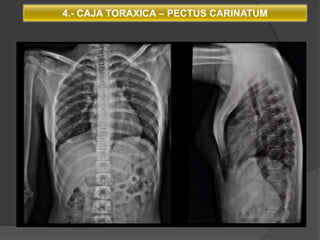 ANATOMIA RADIOLOGICA DEL TORAX 1.pptx