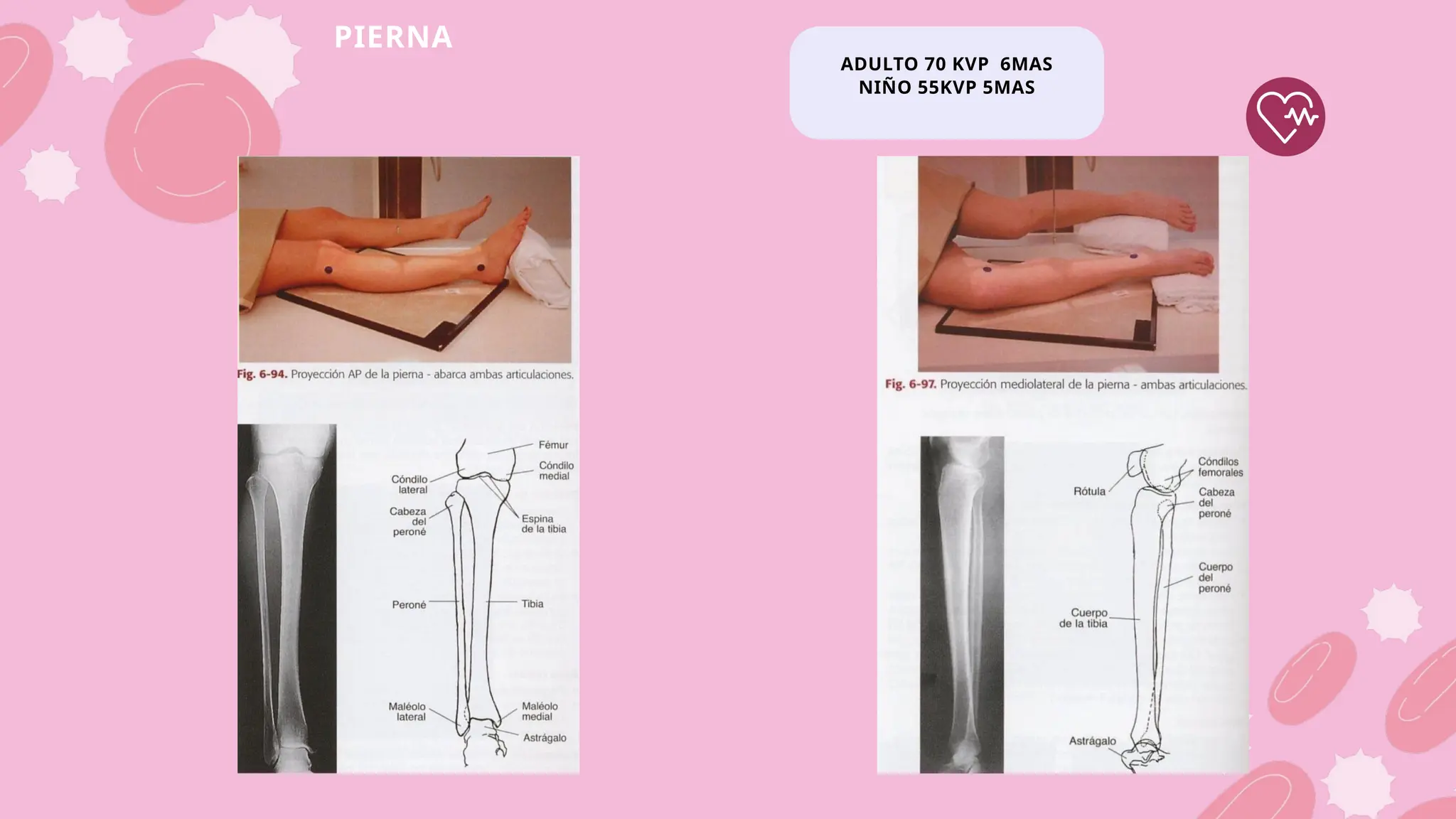 anatomia radiologica de rodilla y sus proyecciones.pptx