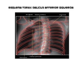 Anatomia radiologica de_torax_parte_2 | PPT