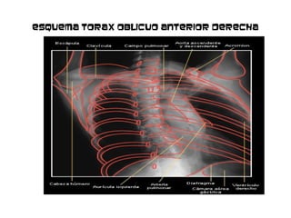 Anatomia radiologica de_torax_parte_2 | PPT