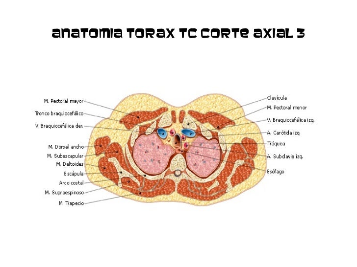 Anatomia radiologica de_torax_parte_2