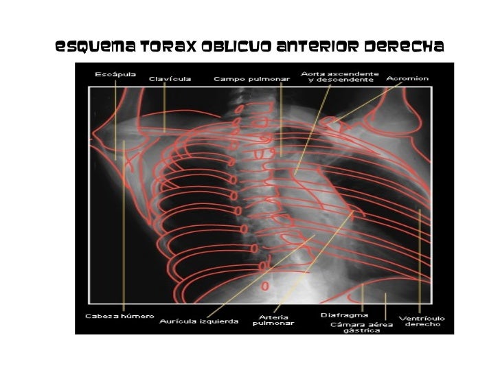 Anatomia radiologica de_torax_parte_2