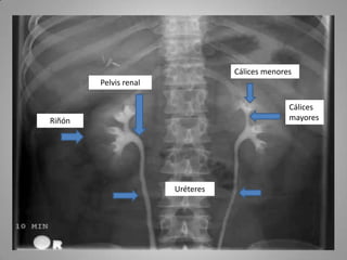 Anatomia renal | PPTX
