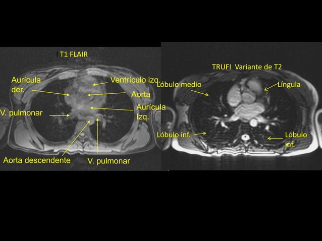 anatomia seccional de torax por rm_250303_151255.pdf