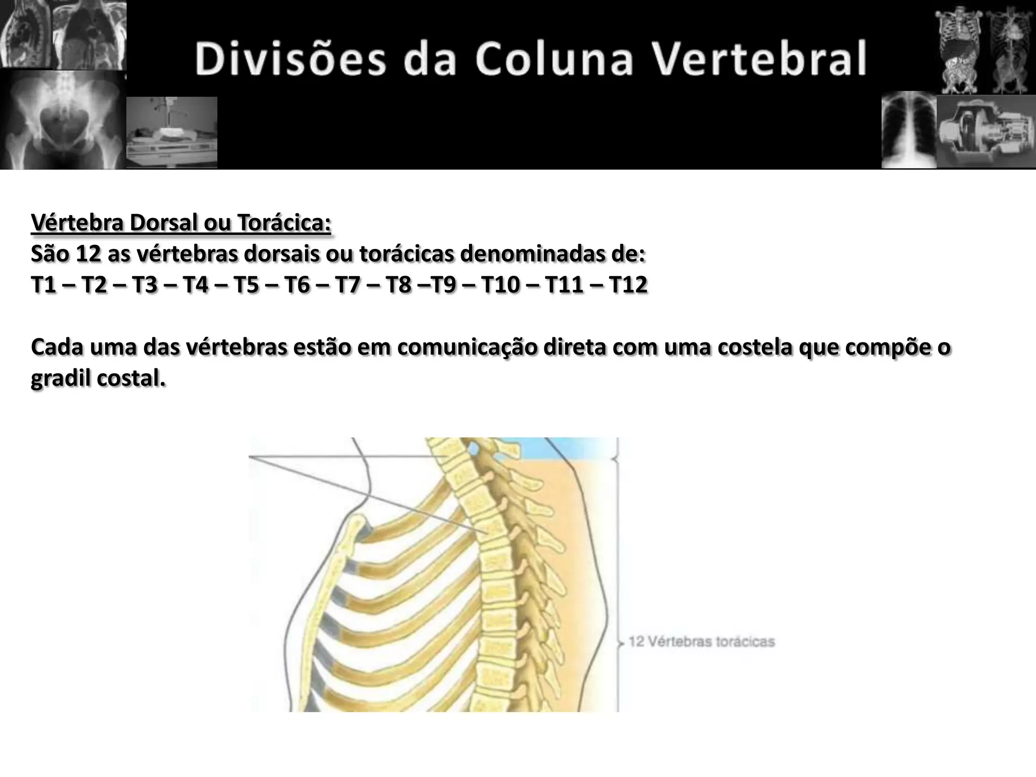 Anatomia óssea coluna vertebral introdução | PPTX