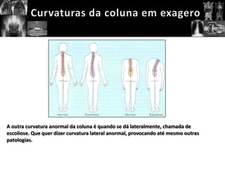 Anatomia óssea coluna vertebral introdução | PPTX