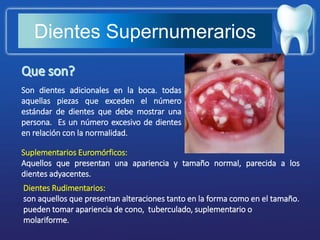 Dientes supernumerarios | PPTX