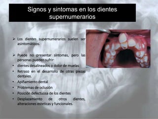 Dientes supernumerarios | PPTX