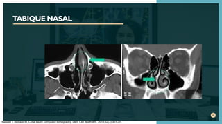 ANATOMIA TOMOGRAFICA DE CARA CIRUGA ORLAY MAXILOFACIAL.pptx