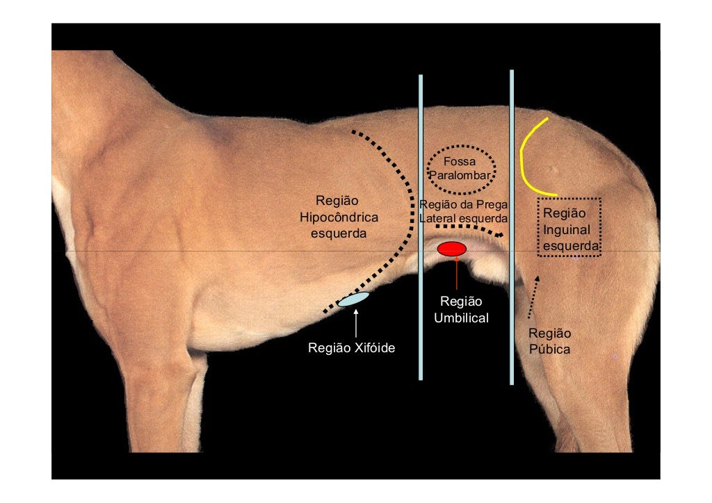Anatomia topográfica acessos - abdome 1