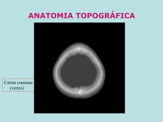Anatomia Topográfica do corpo todo.pdf para estudos | PDF