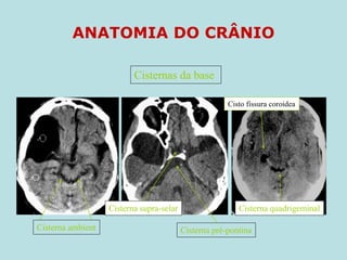 Anatomia Topográfica do corpo todo.pdf para estudos | PDF
