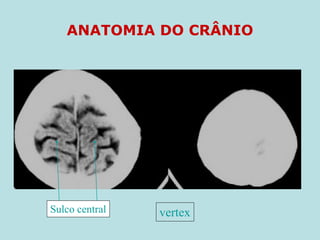 Anatomia Topográfica do corpo todo.pdf para estudos | PDF