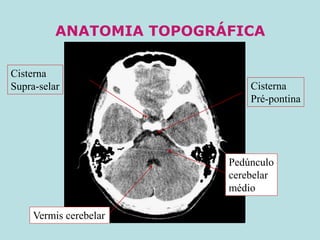 Anatomia Topográfica do corpo todo.pdf para estudos | PDF
