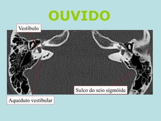 Anatomia Topográfica do corpo todo.pdf para estudos | PDF