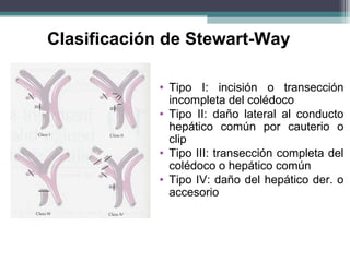 Anatomia vb y lesiones | PPT