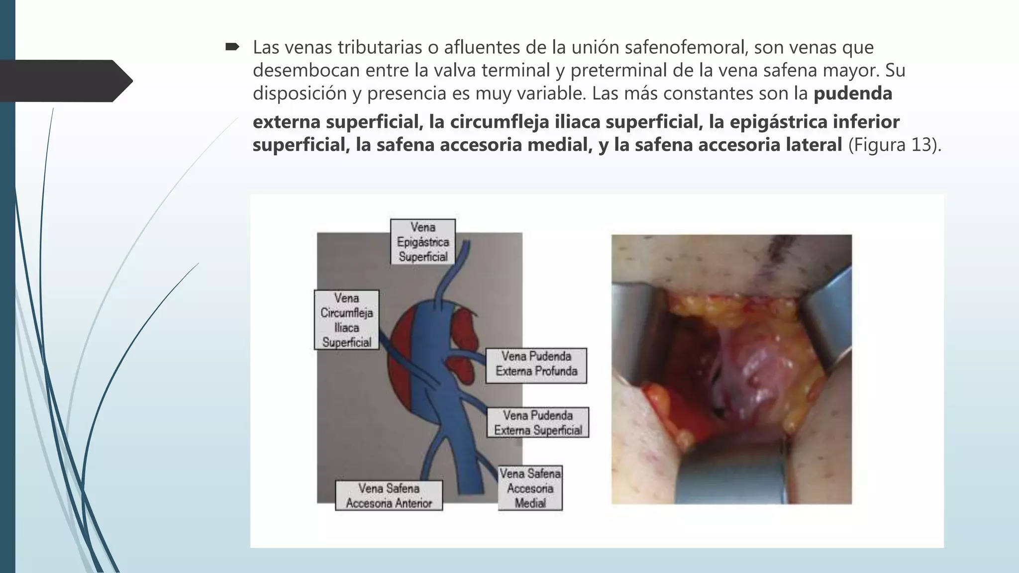 Anatomia venosa de miembros inferiores | PPTX