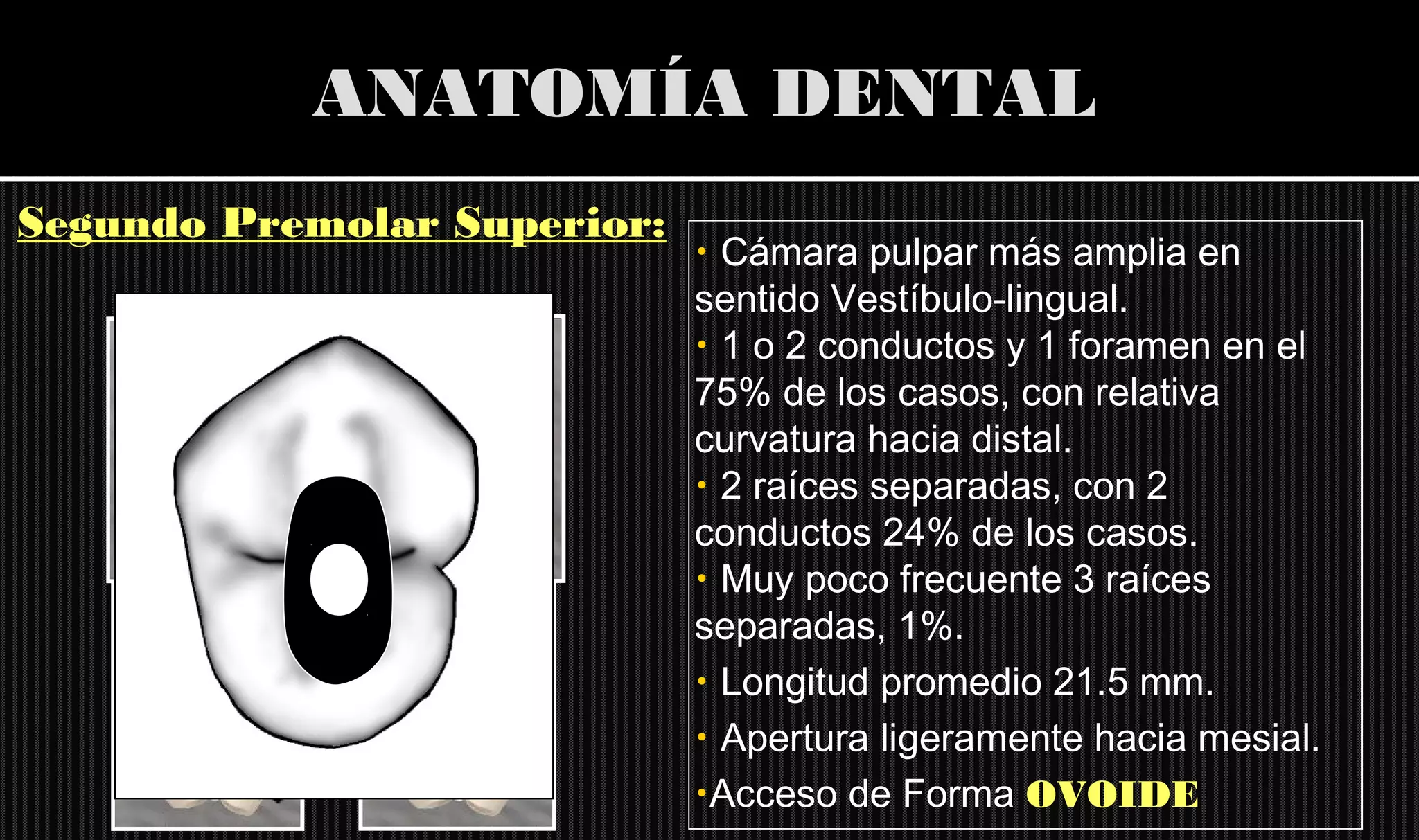 Anatomía y Apertura Cameral. | PPT | Ear, Nose and Throat Conditions ...