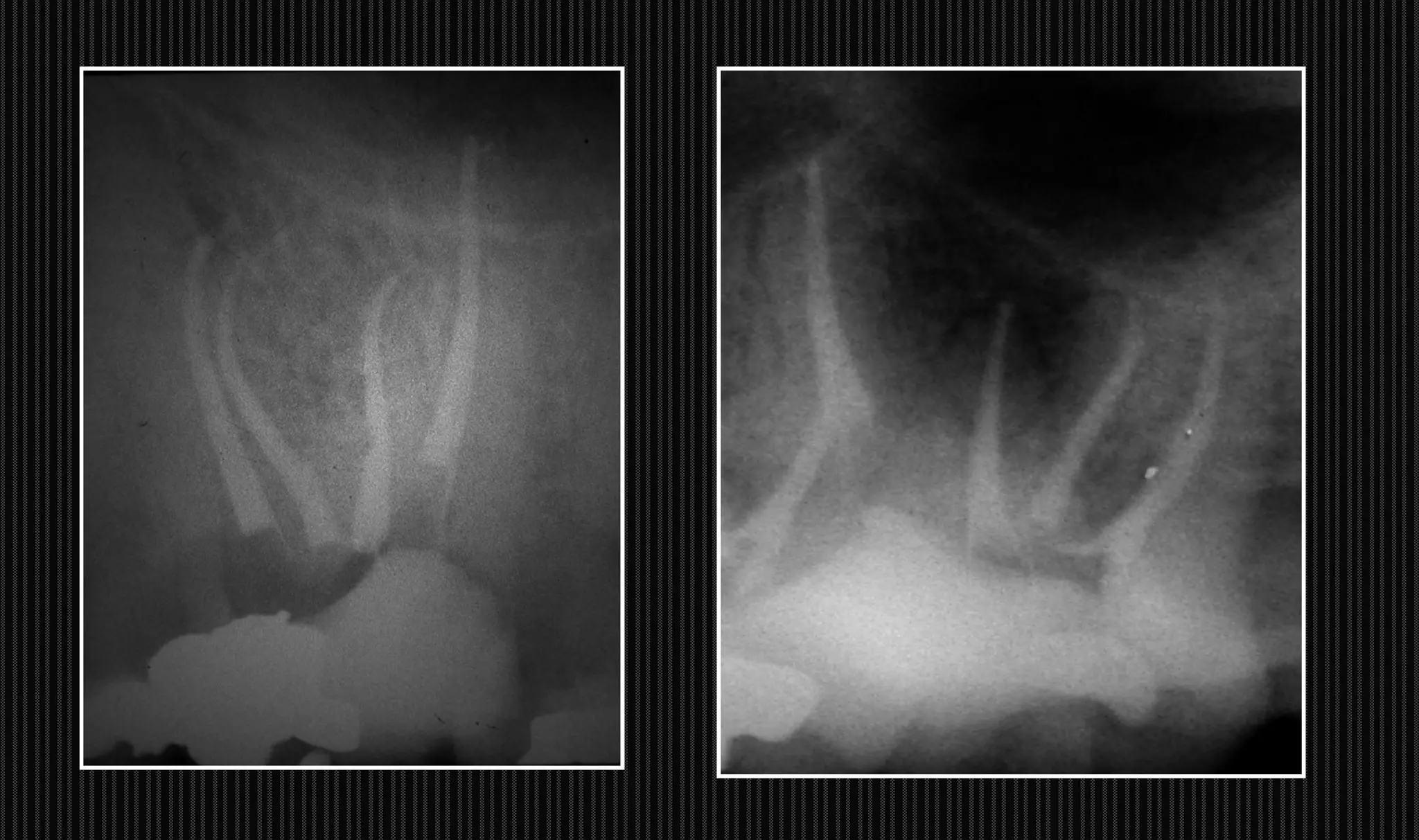Anatomía y Apertura Cameral. | PPT | Ear, Nose and Throat Conditions ...