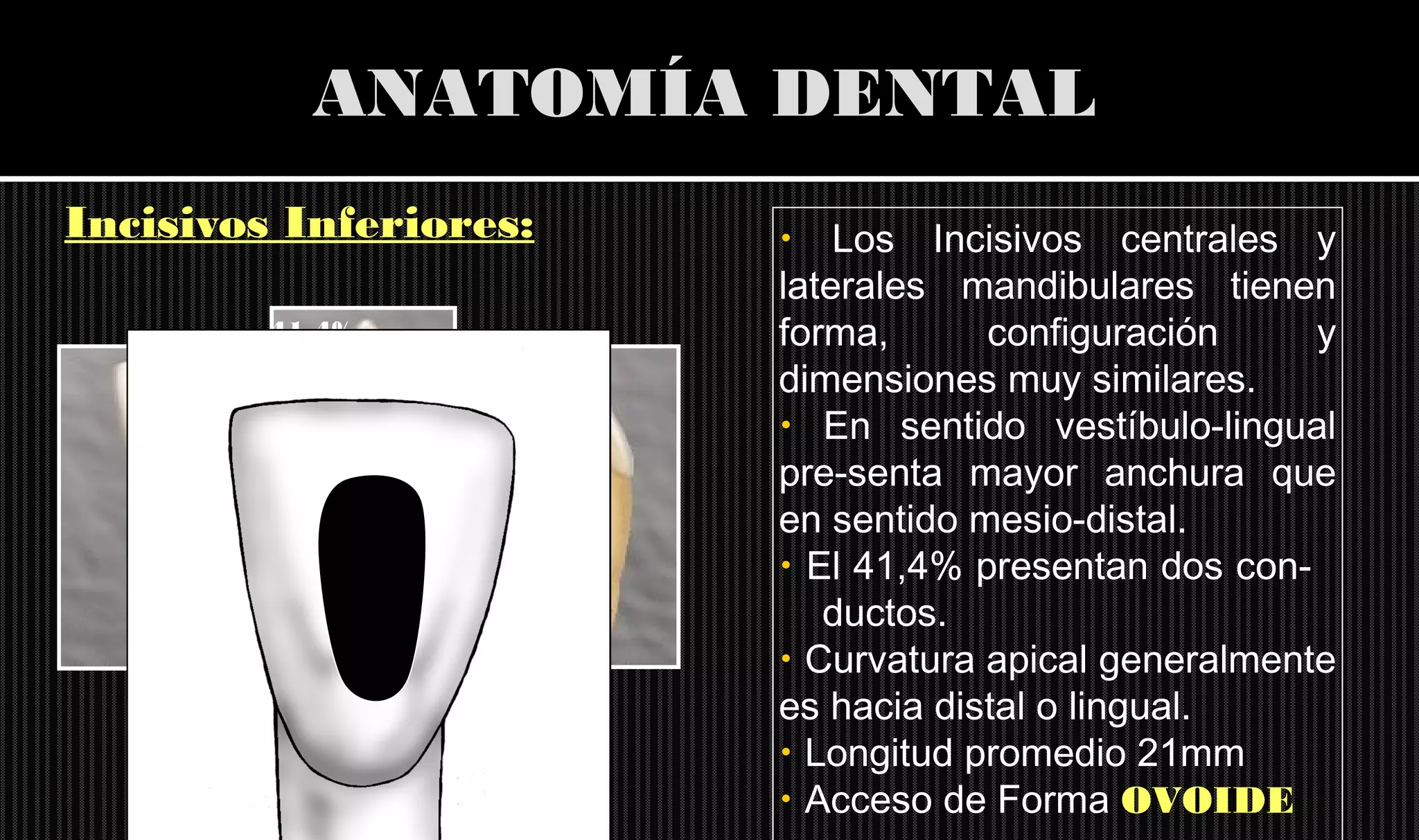 Anatomía y Apertura Cameral. | PPT | Ear, Nose and Throat Conditions ...