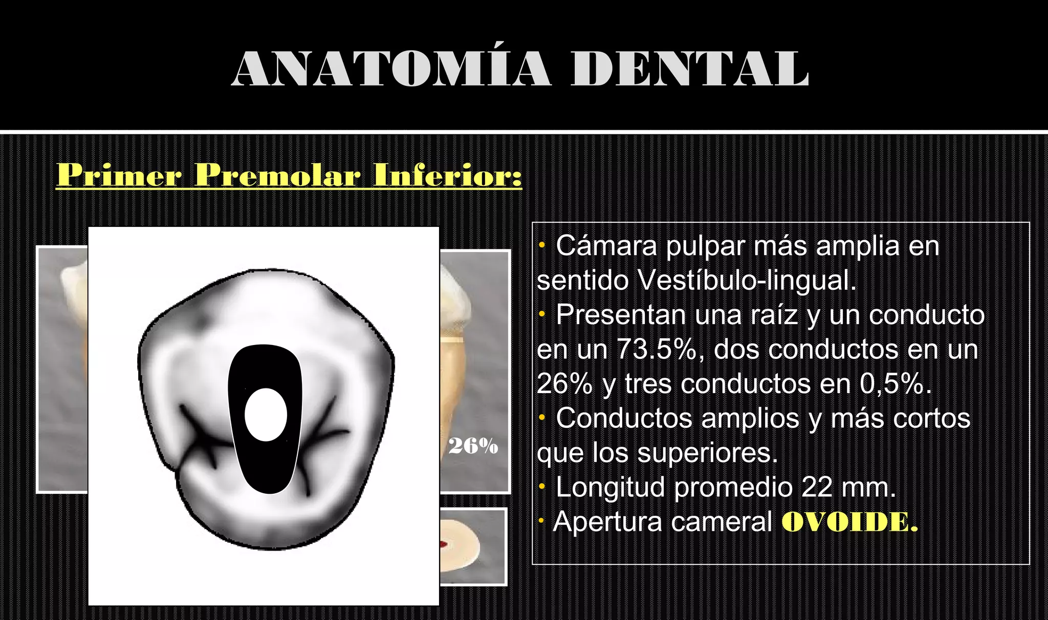 Anatomía y Apertura Cameral. | PPT | Ear, Nose and Throat Conditions ...